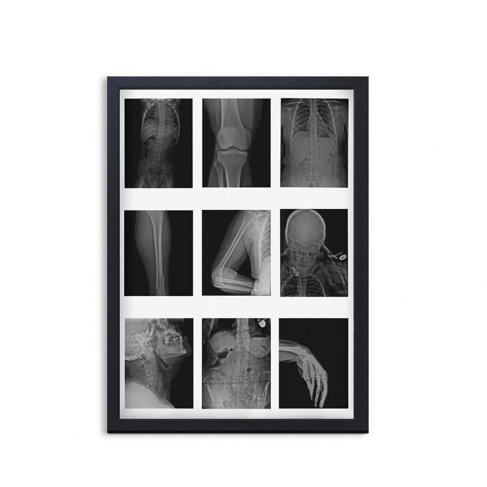 Skeleton Anatomy X-ray Printable Art Digital Collage of Human Body ...