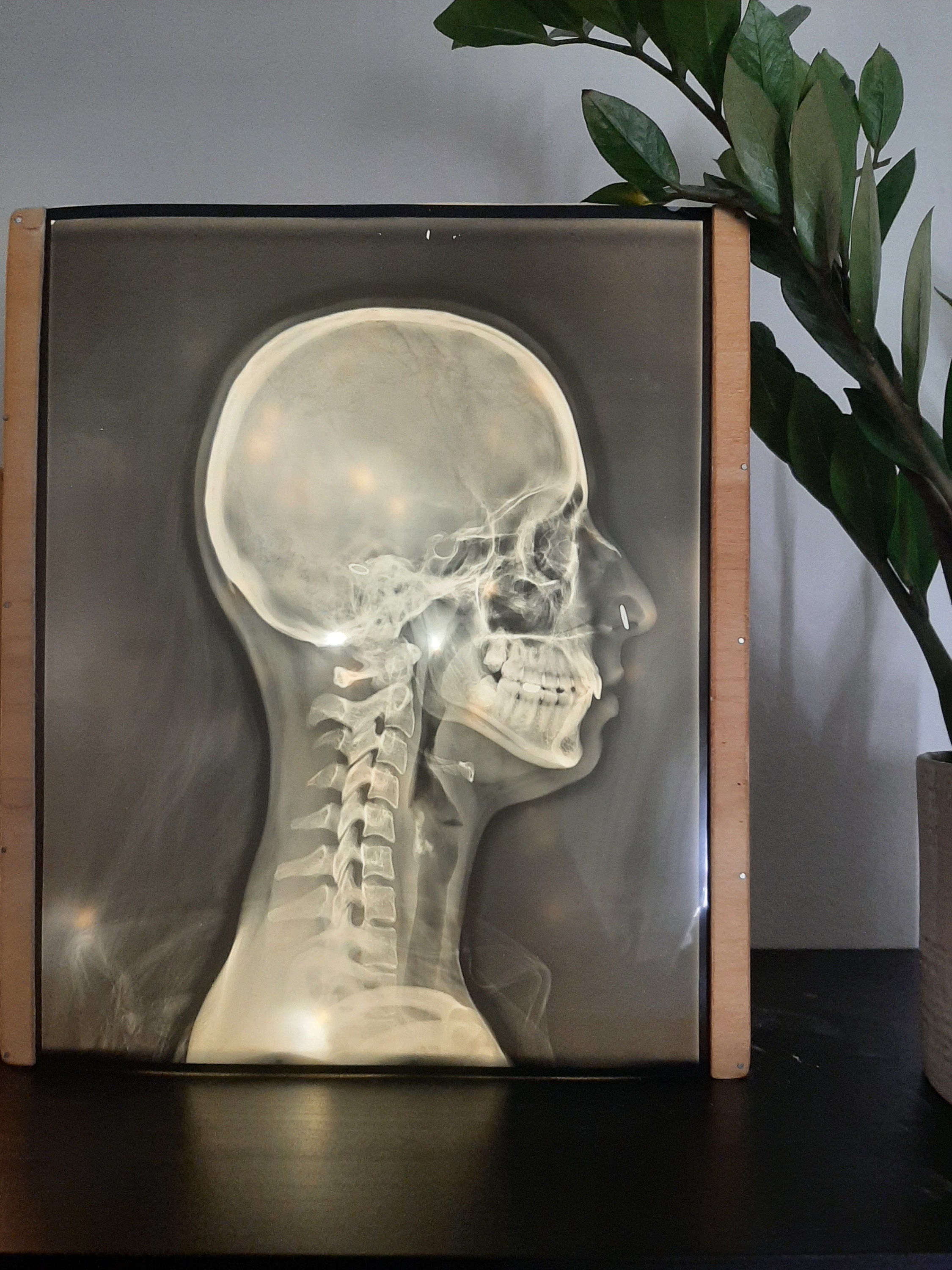 Printed X-ray Films | Wall Art | Radiology | Homedecor | Skull Bones ...