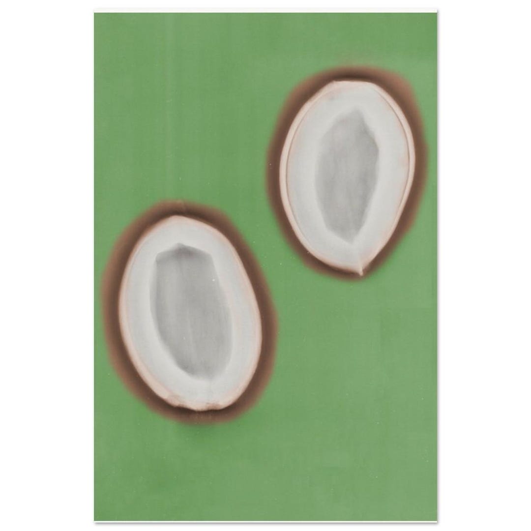 Museum-quality Coconut X-ray Poster | Archival Matte Paper Print - Etsy