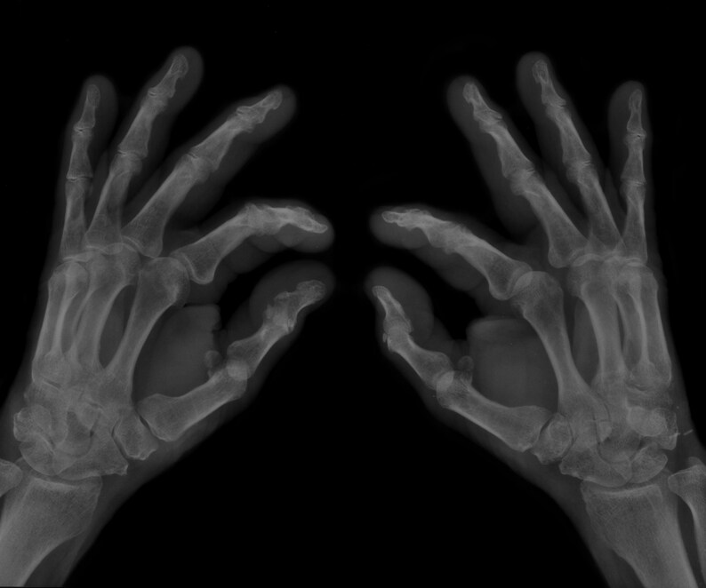 Printed X-ray Films | Wall Art | Radiology | Homedecor | Skull Bones ...