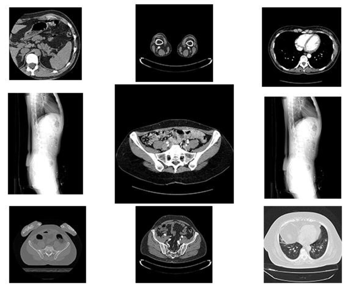 CT Scan Art | Frames + Videos! | Full Body & Single Body Parts ...