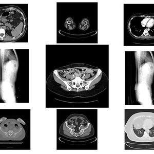 CT Scan Art | Frames + Videos! | Full Body & Single Body Parts ...
