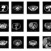CT Scan Art | Frames + Videos! | Full Body & Single Body Parts ...