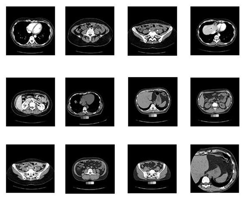 CT Scan Art | Frames + Videos! | Full Body & Single Body Parts ...