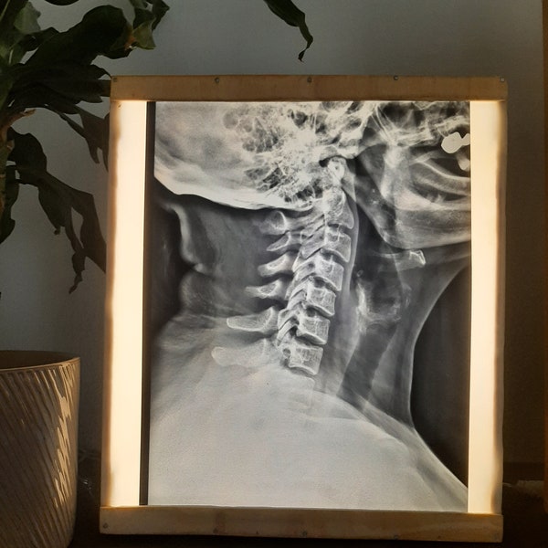 Xray Art - Etsy