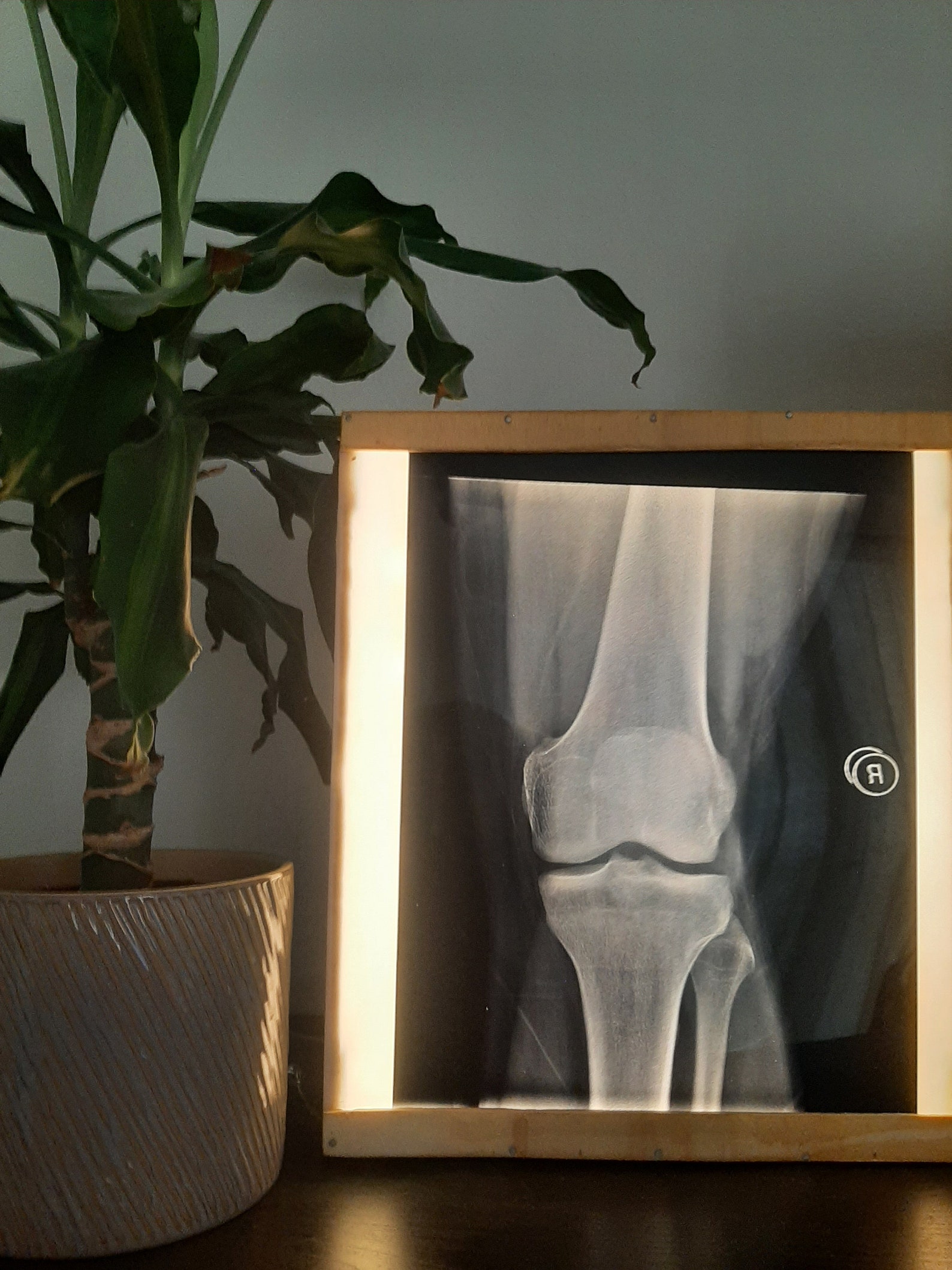 Printed X-ray Films | Wall Art | Radiology | Homedecor | Skull Bones ...