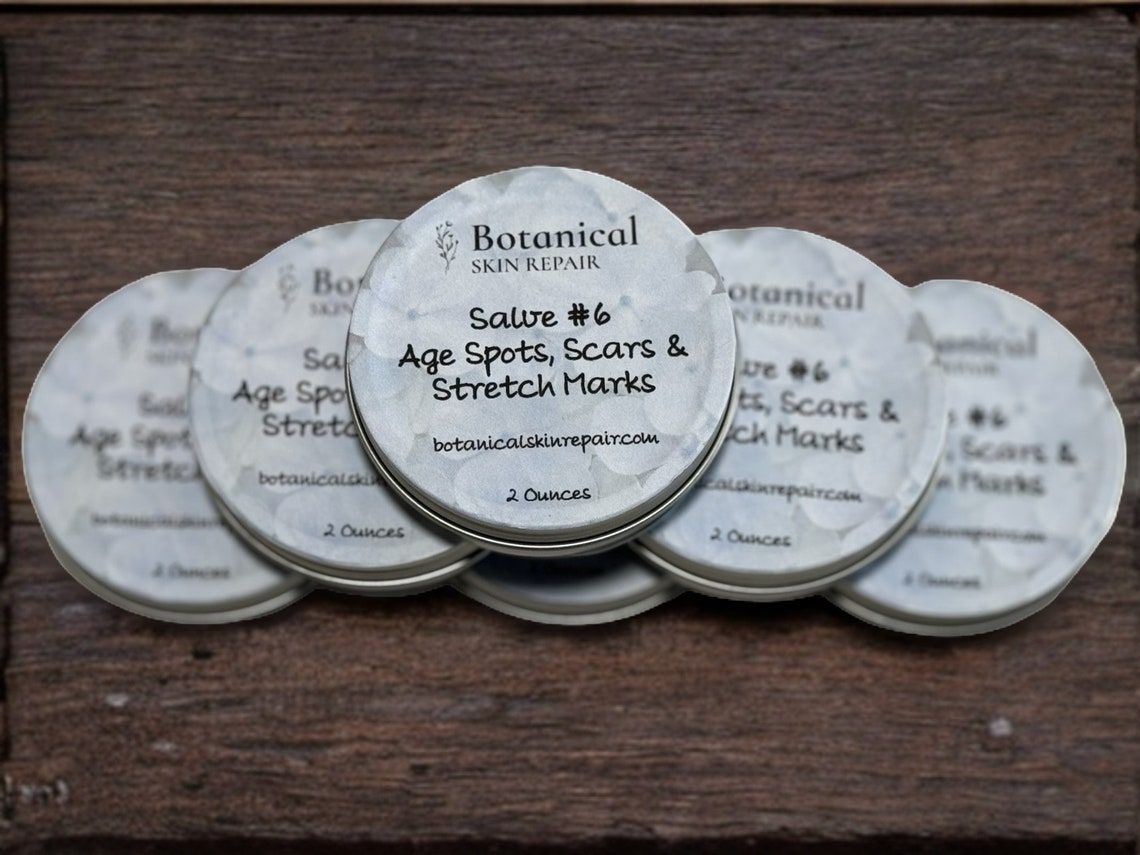 Age Spots, Scars, & Stretch Marks Salve - Etsy