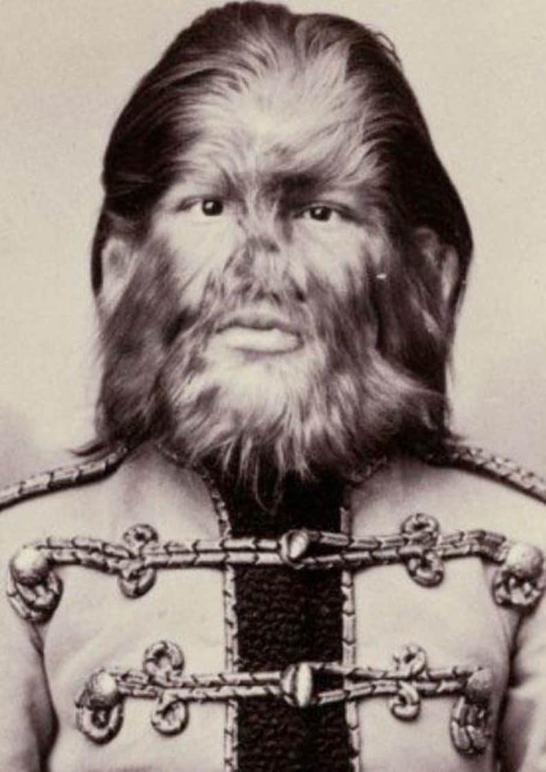 9XP0226 – Bizarre Victorian Era Human Oddities Circus Freaks - Etsy