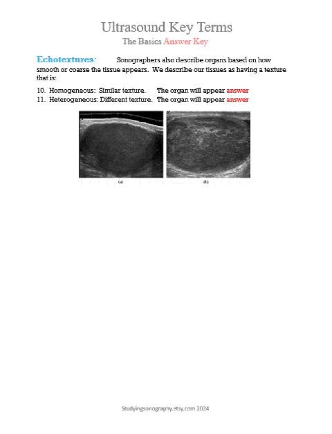 Ultrasound Basic Key Terms Study Document (blank and Answer Key) - Etsy