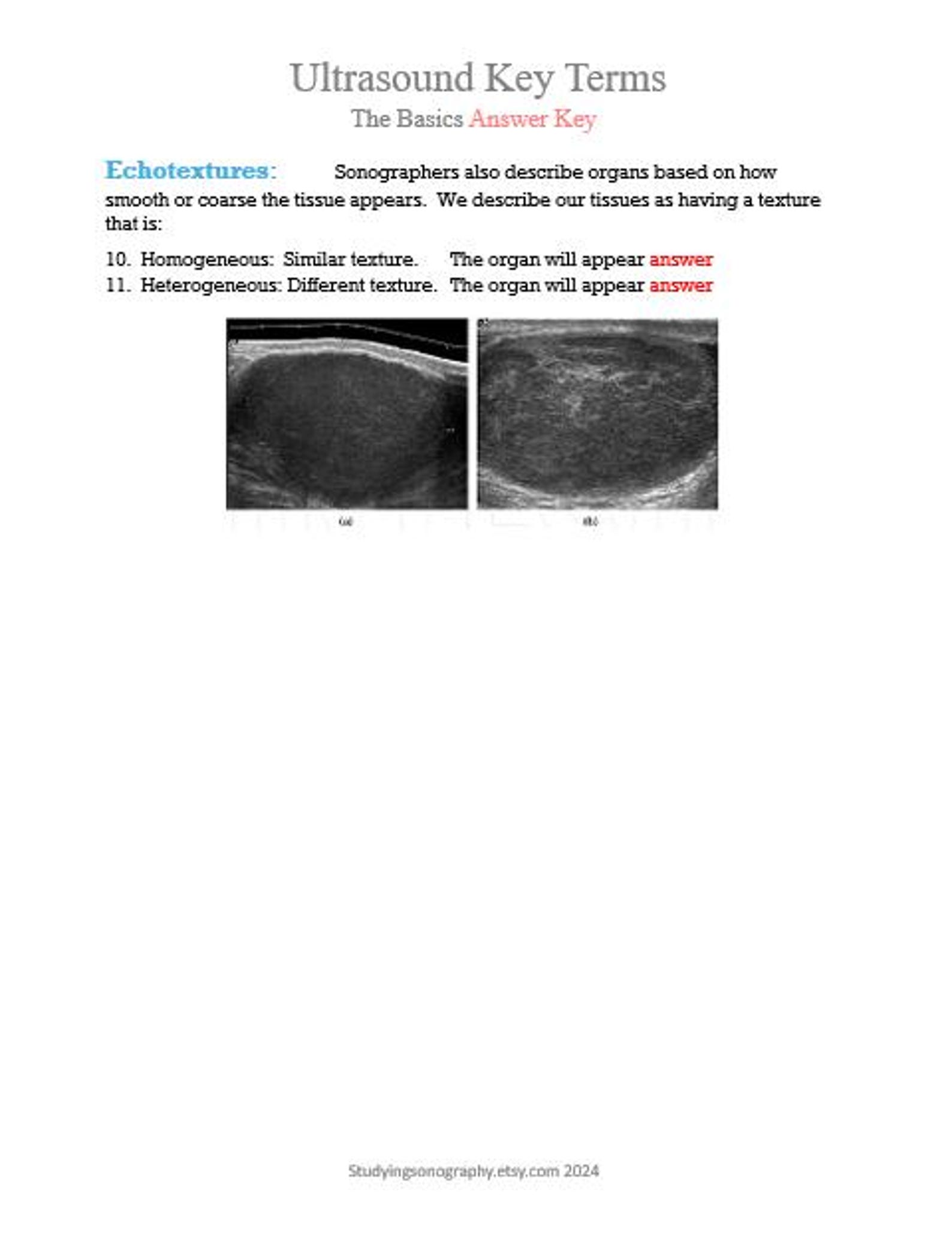 Ultrasound Basic Key Terms Study Document (blank and Answer Key) - Etsy