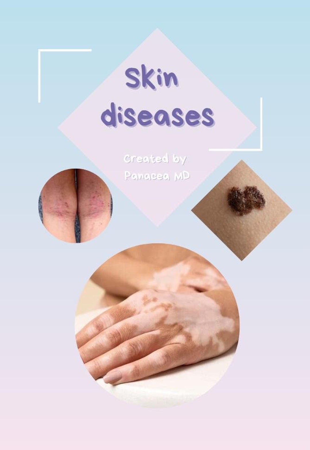 Skin Diseases Cheat Sheet for Medical and Nursing School Students and ...