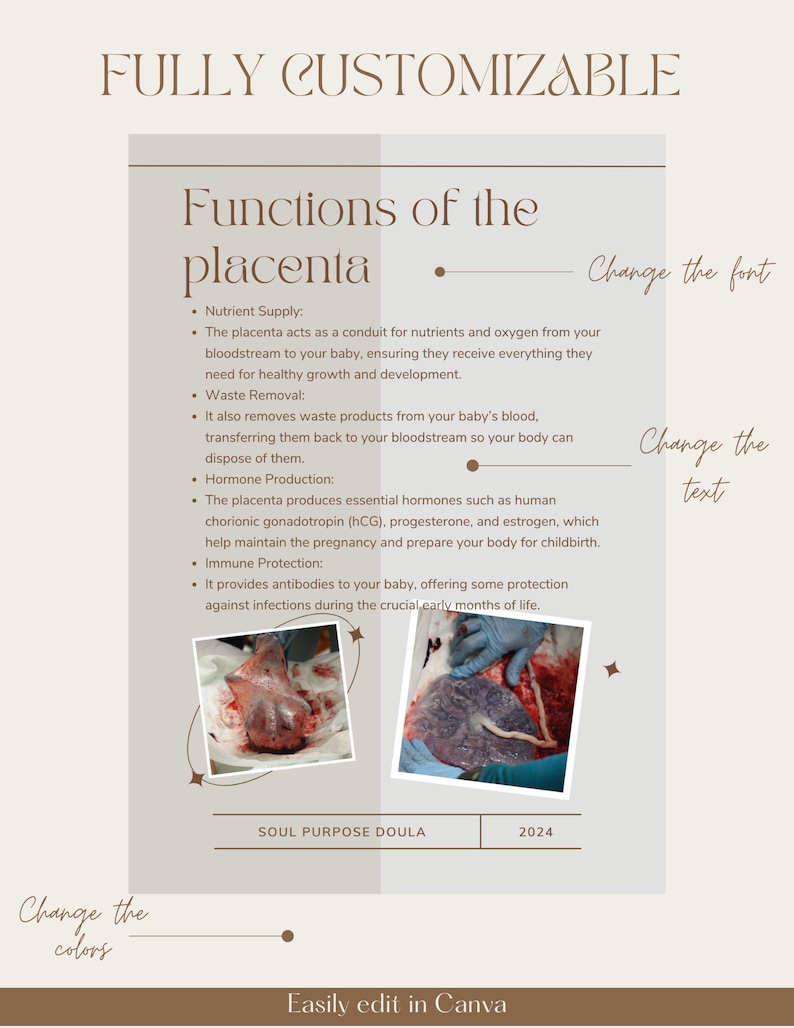 Placenta Handout, Placenta Encapsulation Contract, Instant Download ...