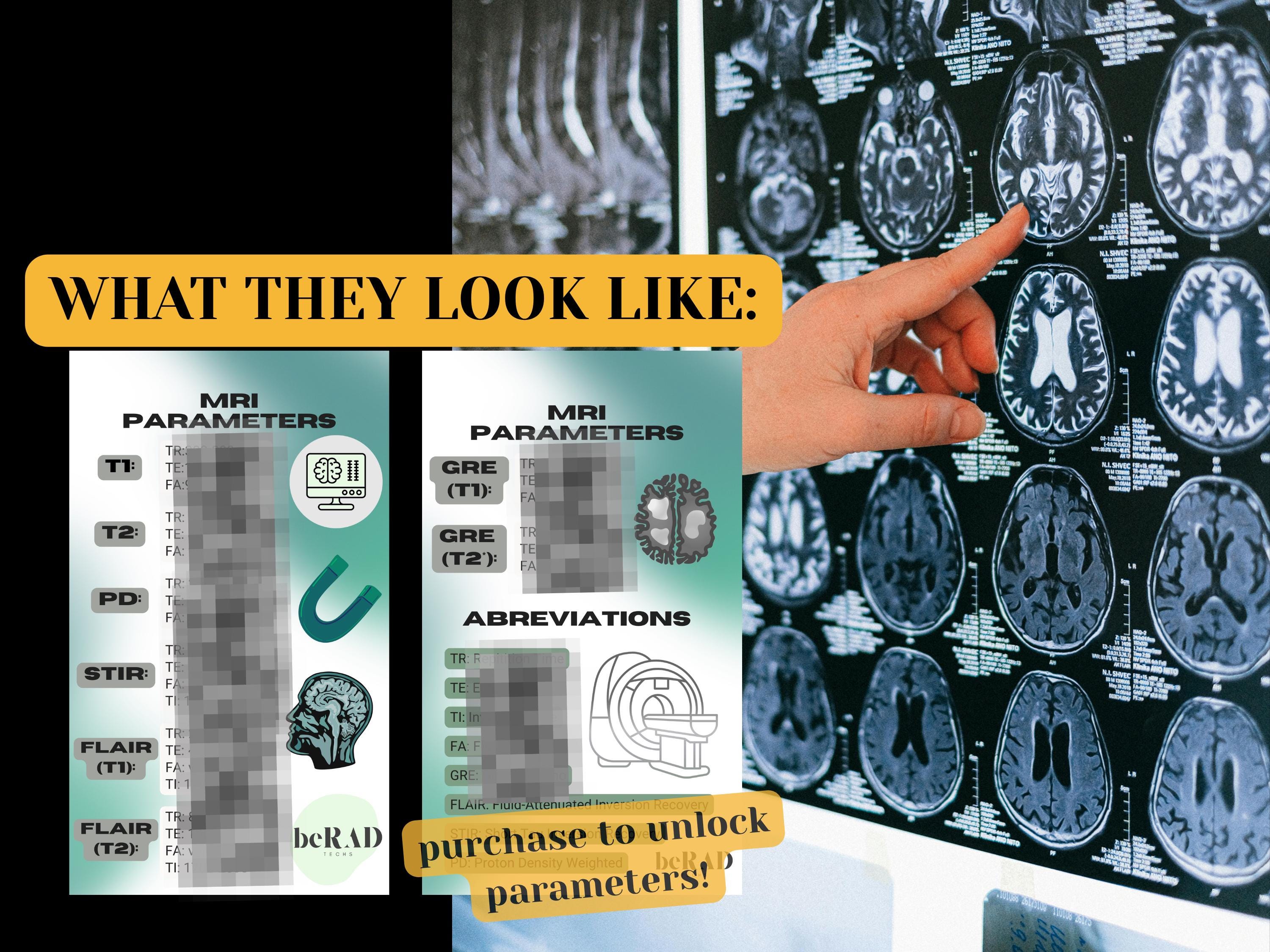 MRI Tech Badge Buddy: Scanning Parameters Cheat Sheet (digital Download) GREEN - Etsy