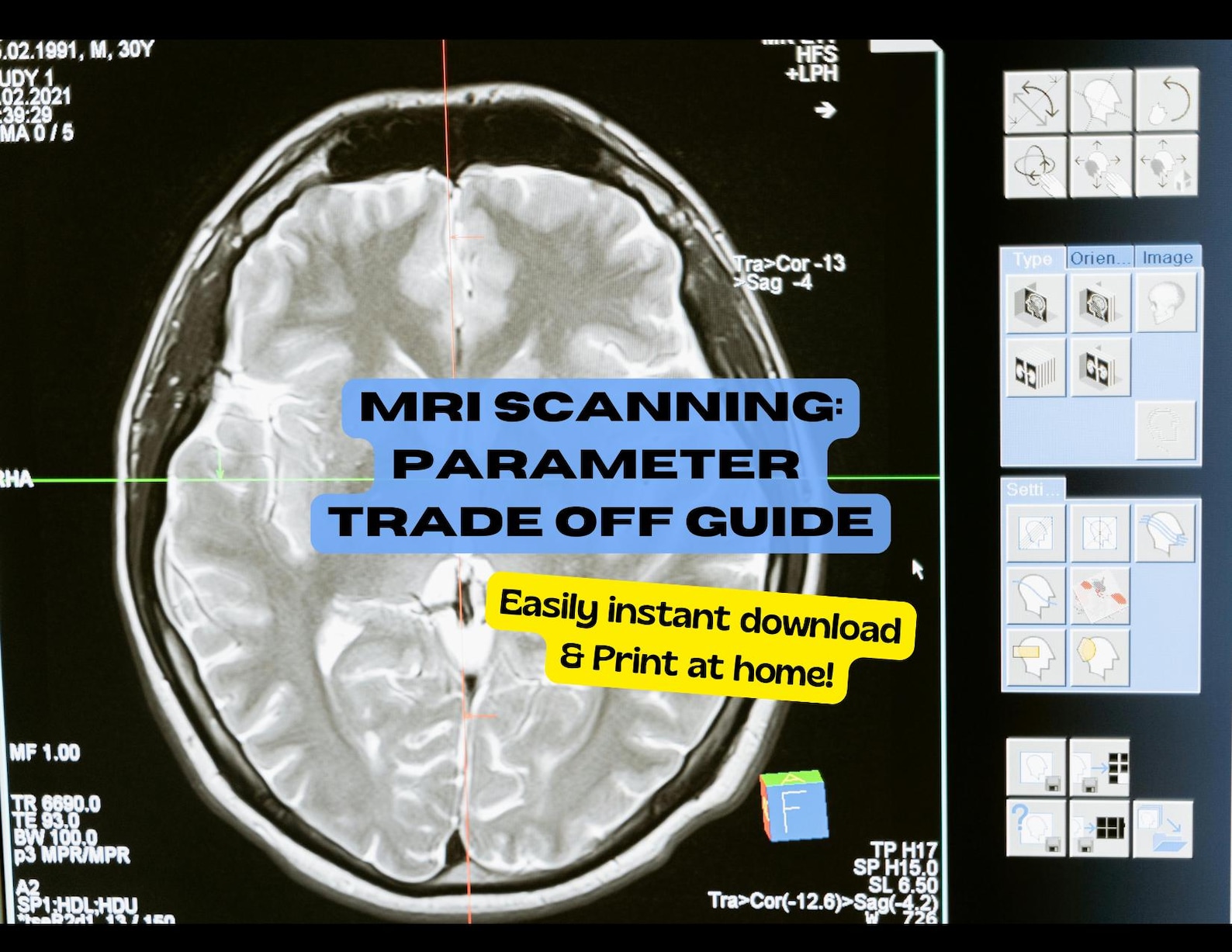 MRI Parameter Guide: Scan Tradeoffs Cheat Sheet (digital Download) - Etsy