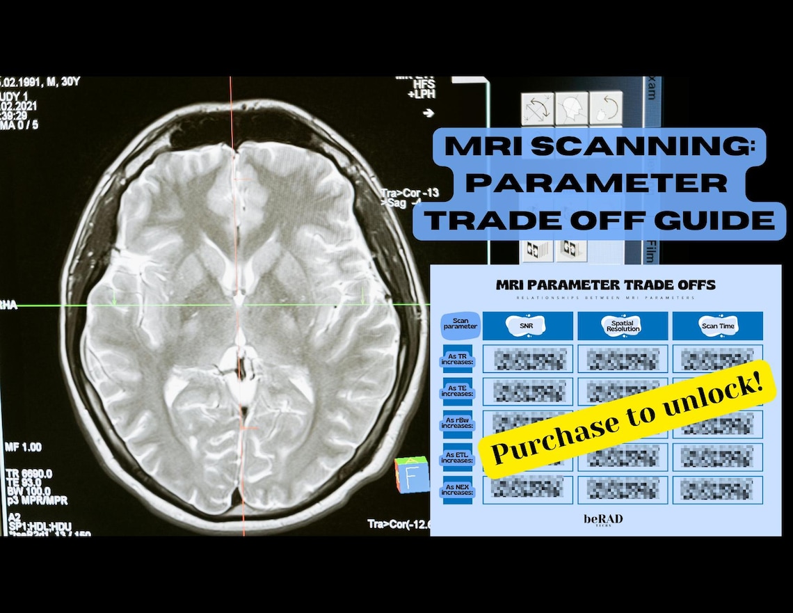 MRI Parameter Guide: Scan Tradeoffs Cheat Sheet (digital Download) - Etsy