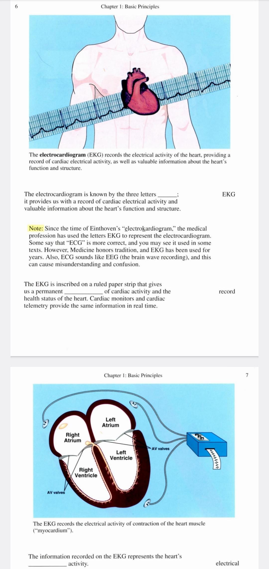 Rapid Interpretation of Ekg's, 6th Edition | ECG Analysis Made Easy ...