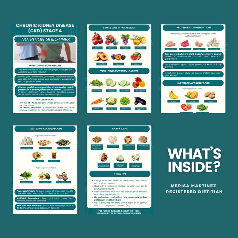 CKD Stage 4 Nutrition Guide – Renal Diet Printable Handout (digital ...