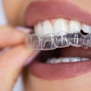 Upper and Lower Dentures - Etsy