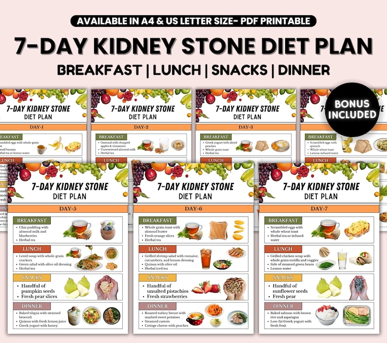 Kidney Stone 7-day Diet Plan Printable, Low Oxalate Foods, Renal Diet ...