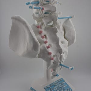 Lumbar/sacrum Model of Pain Management Procedures - Etsy