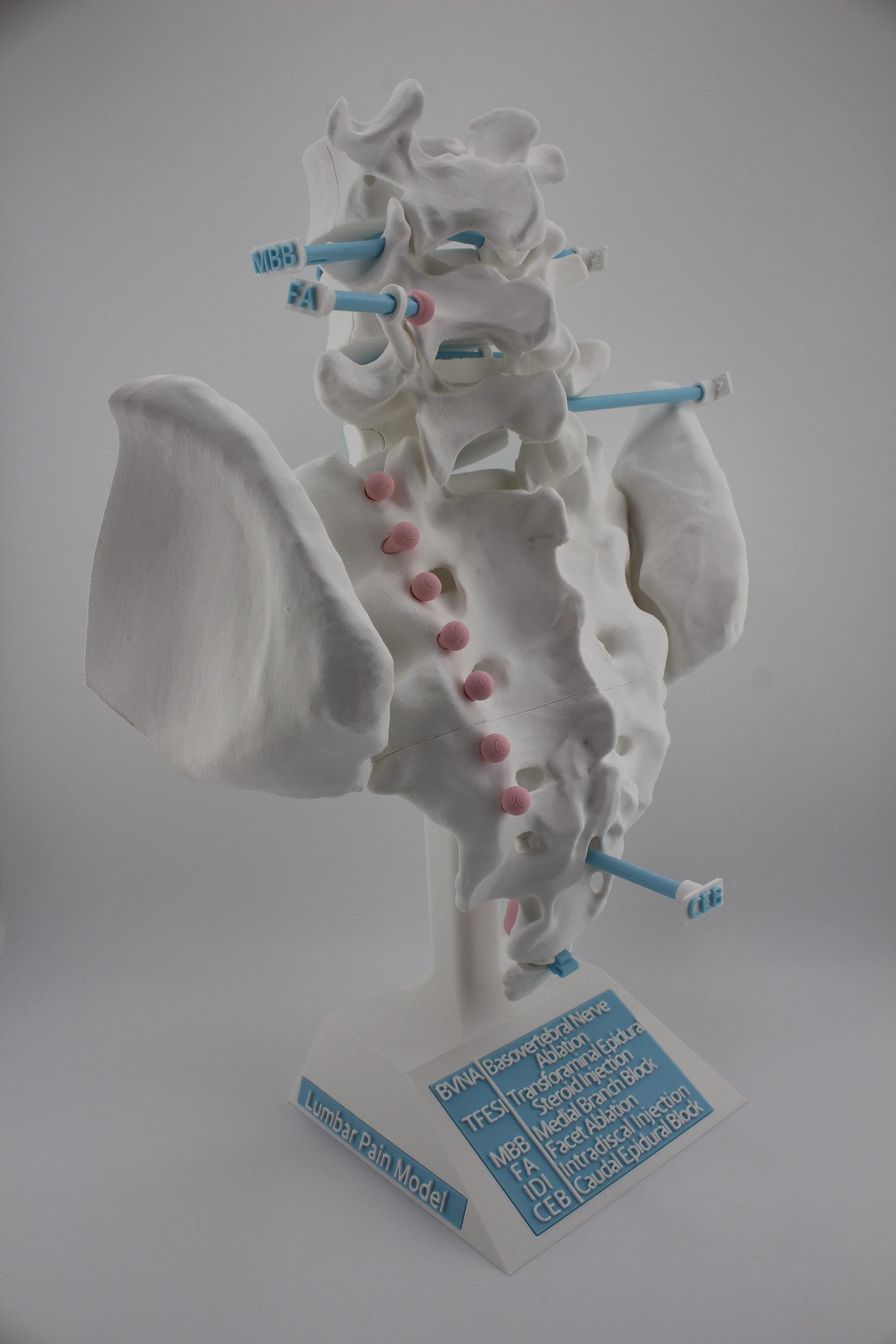 Lumbar/sacrum Model of Pain Management Procedures - Etsy