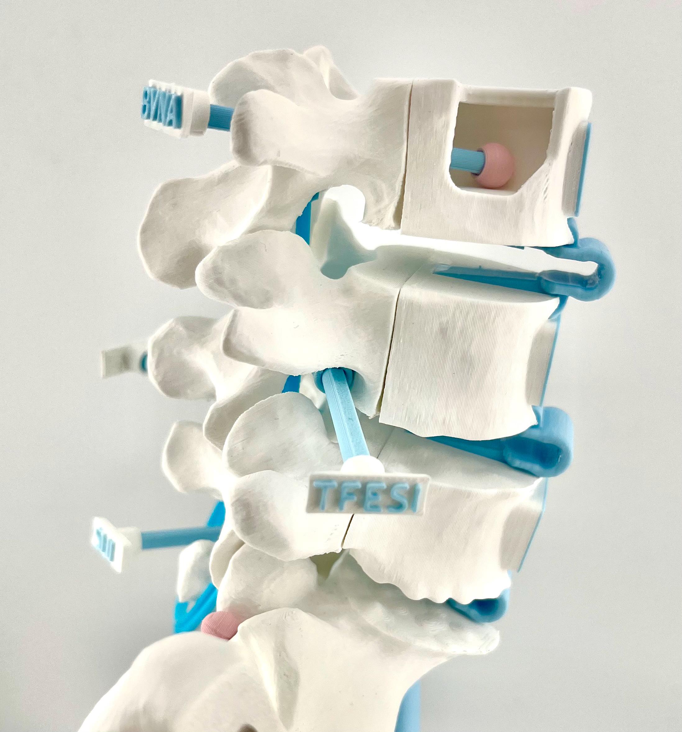 Lumbar/sacrum Model of Pain Management Procedures - Etsy