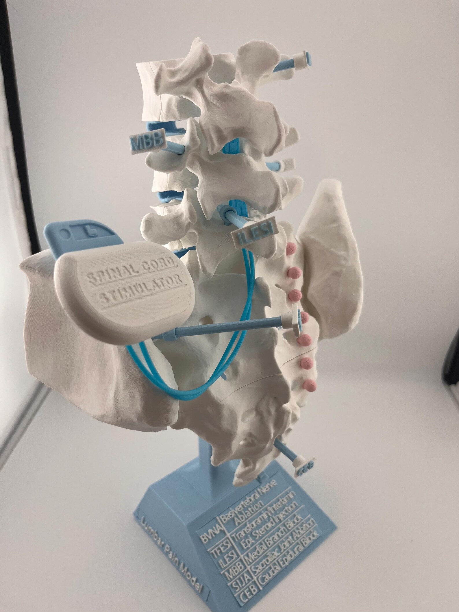 Lumbar/sacrum Model of Pain Management Procedures - Etsy