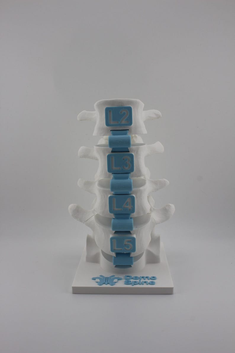 Lumbar Spine Model, Detachable Vertebra, Fully Articulating Joints - Etsy