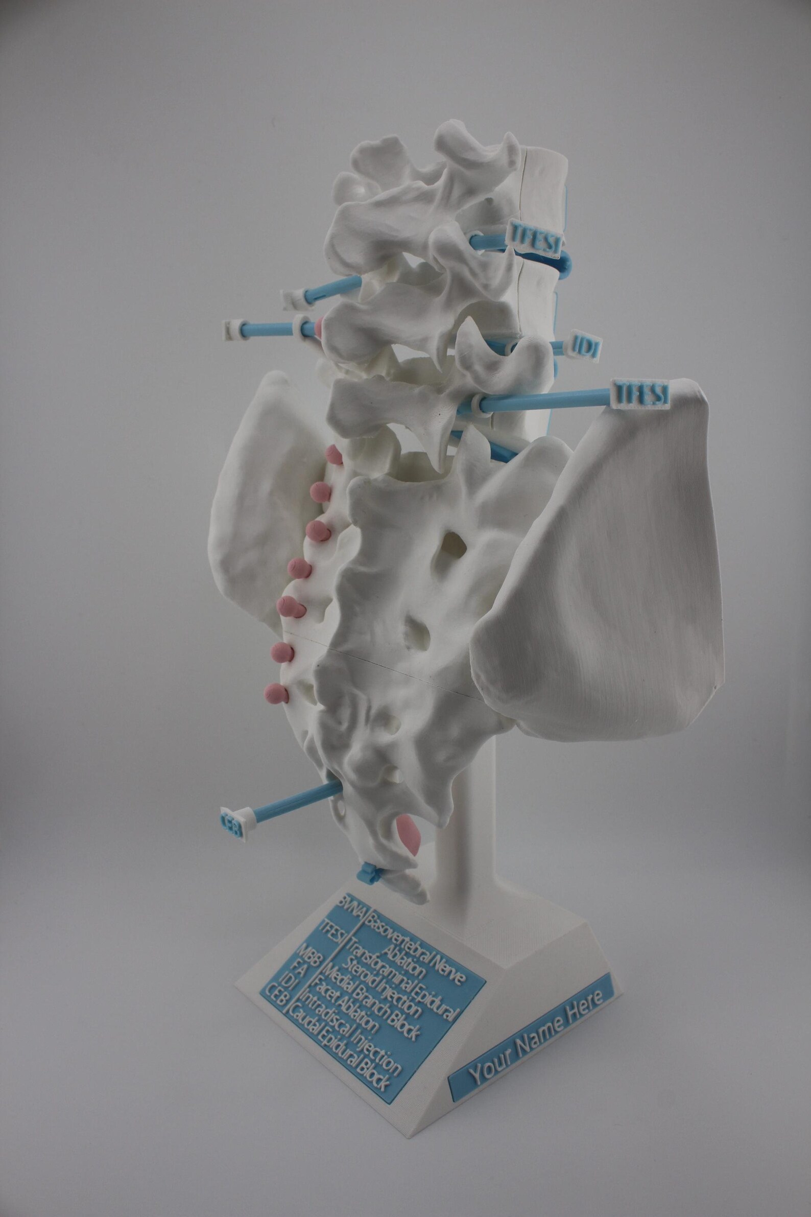 Lumbar/sacrum Model of Pain Management Procedures - Etsy