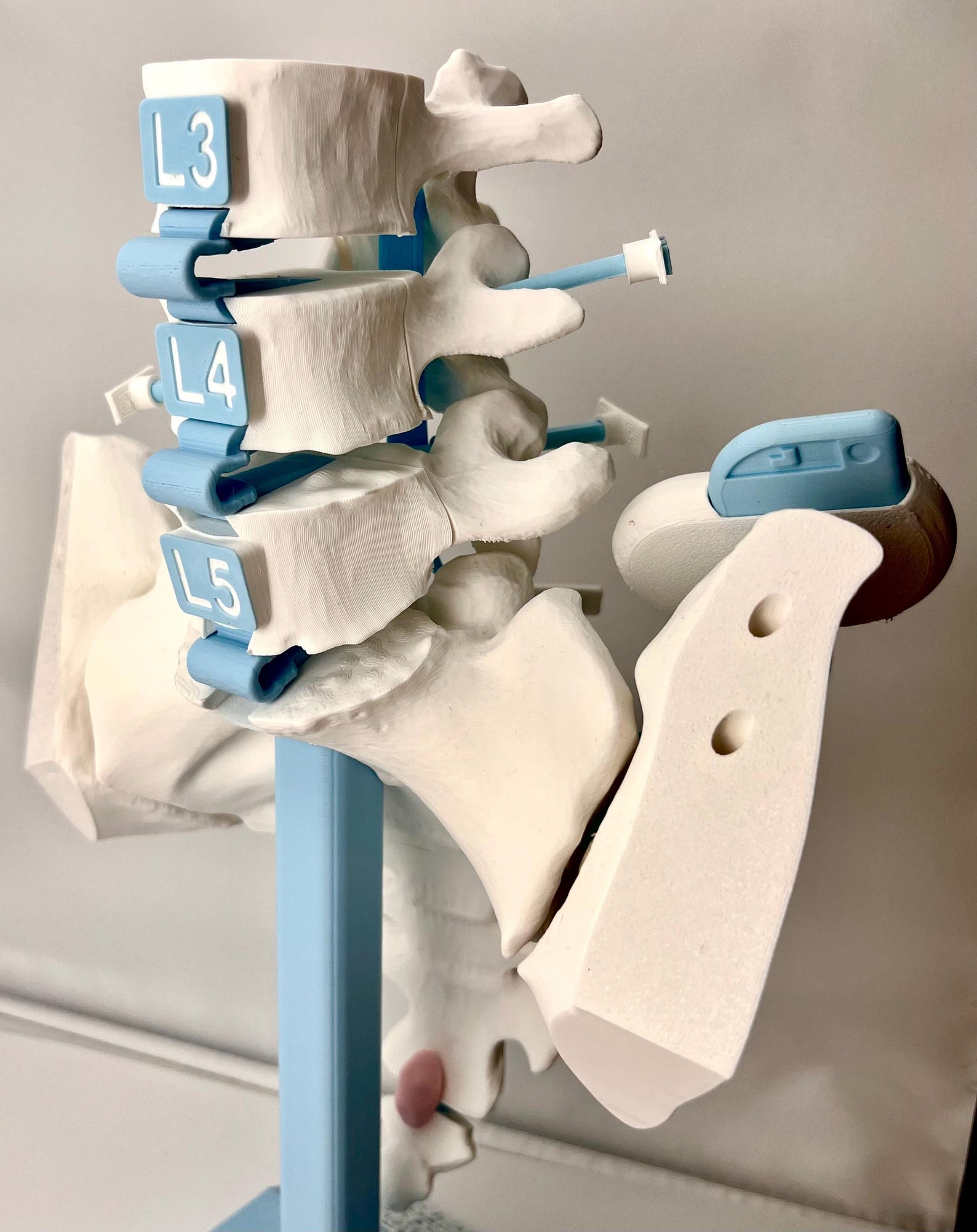 Lumbar/sacrum Model of Pain Management Procedures - Etsy