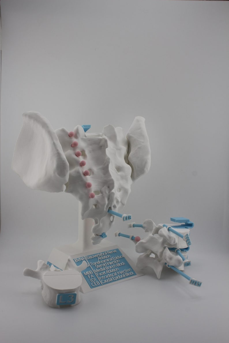 Lumbar/sacrum Model of Pain Management Procedures - Etsy
