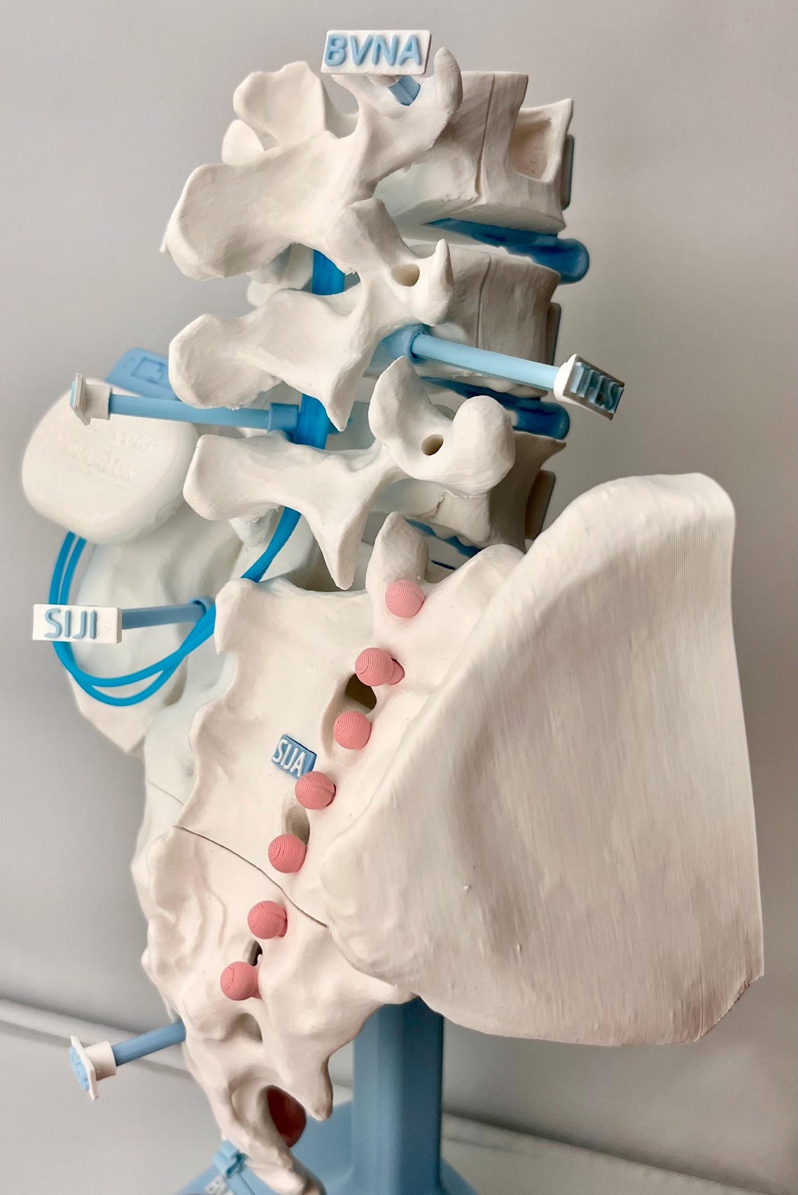 Lumbar/sacrum Model of Pain Management Procedures - Etsy