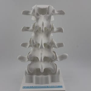 Lumbar Spine Model, Detachable Vertebra, Fully Articulating Joints - Etsy