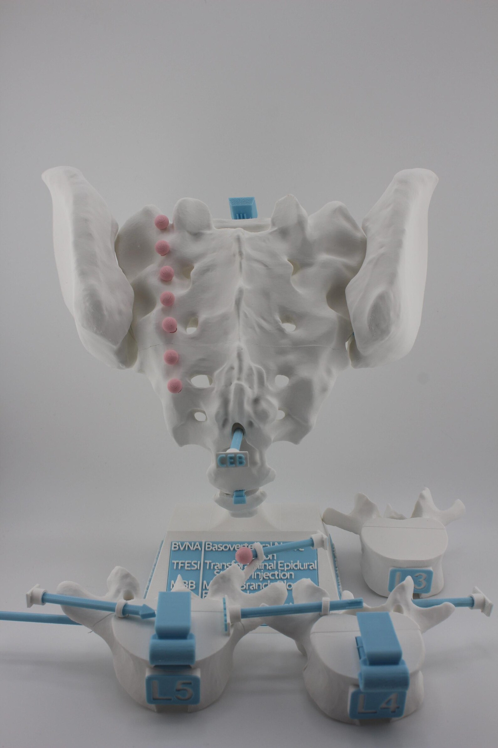 Lumbar/sacrum Model of Pain Management Procedures - Etsy