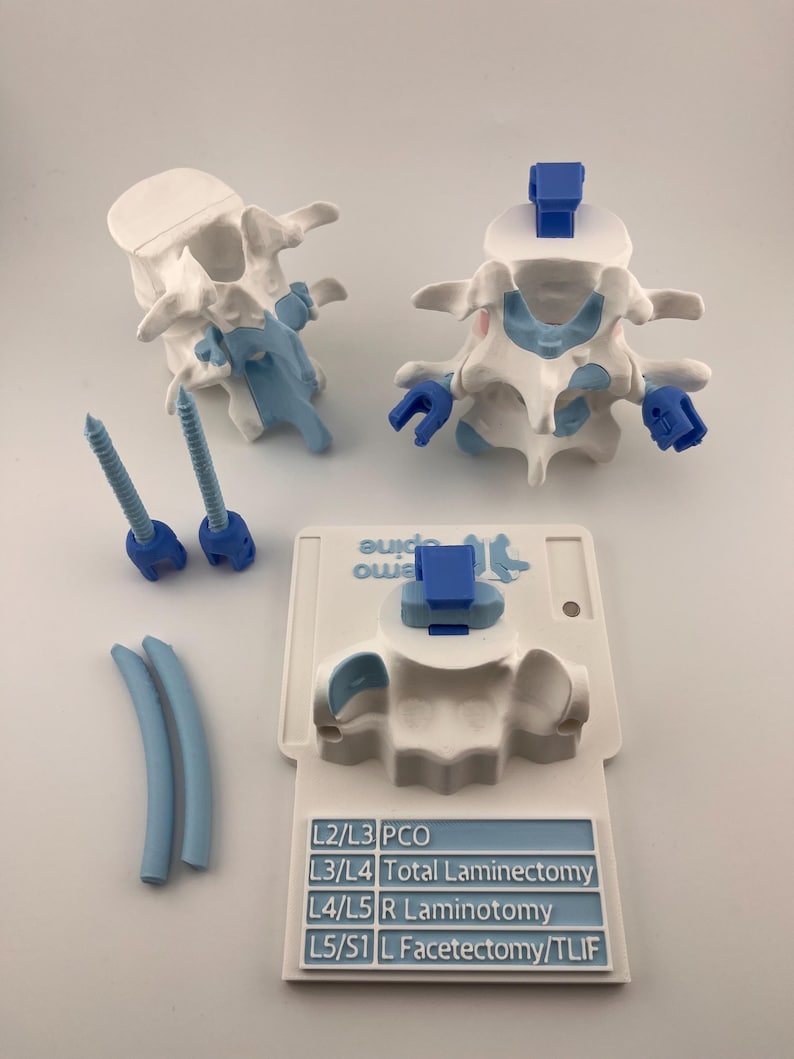 Lumbar Spine Model to Demonstrate Procedures, Detachable Vertebra ...