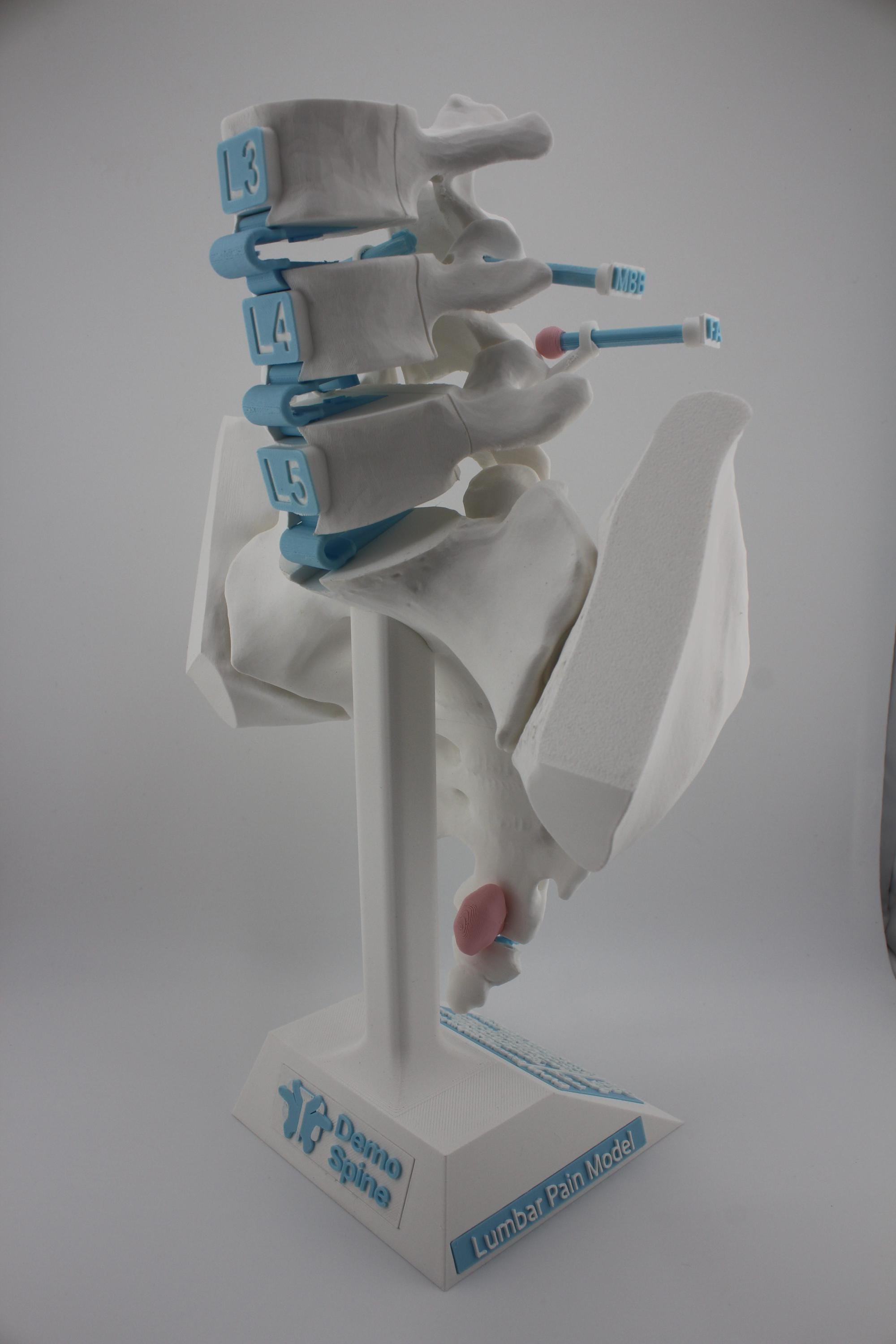 Lumbar/sacrum Model of Pain Management Procedures - Etsy