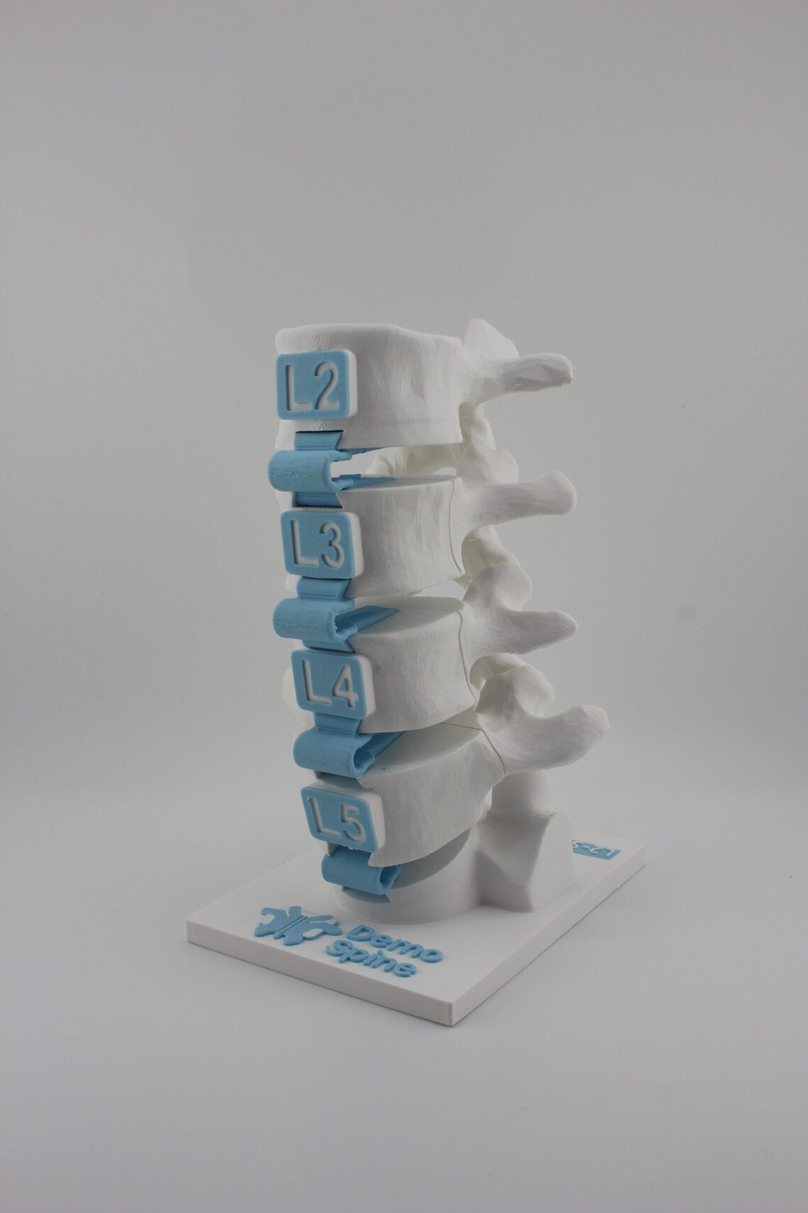 Lumbar Spine Model, Detachable Vertebra, Fully Articulating Joints - Etsy