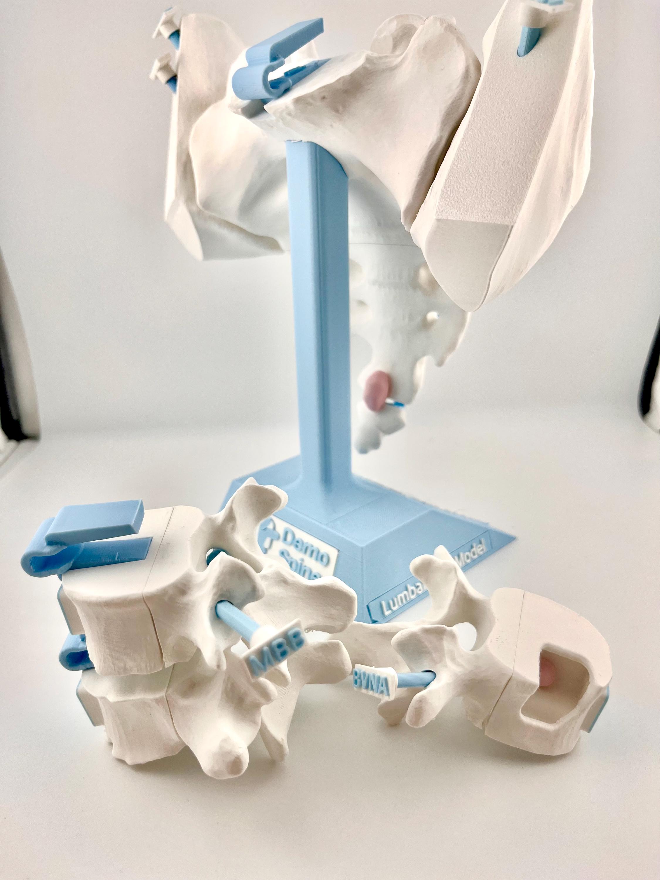 Lumbar/sacrum Model of Pain Management Procedures - Etsy