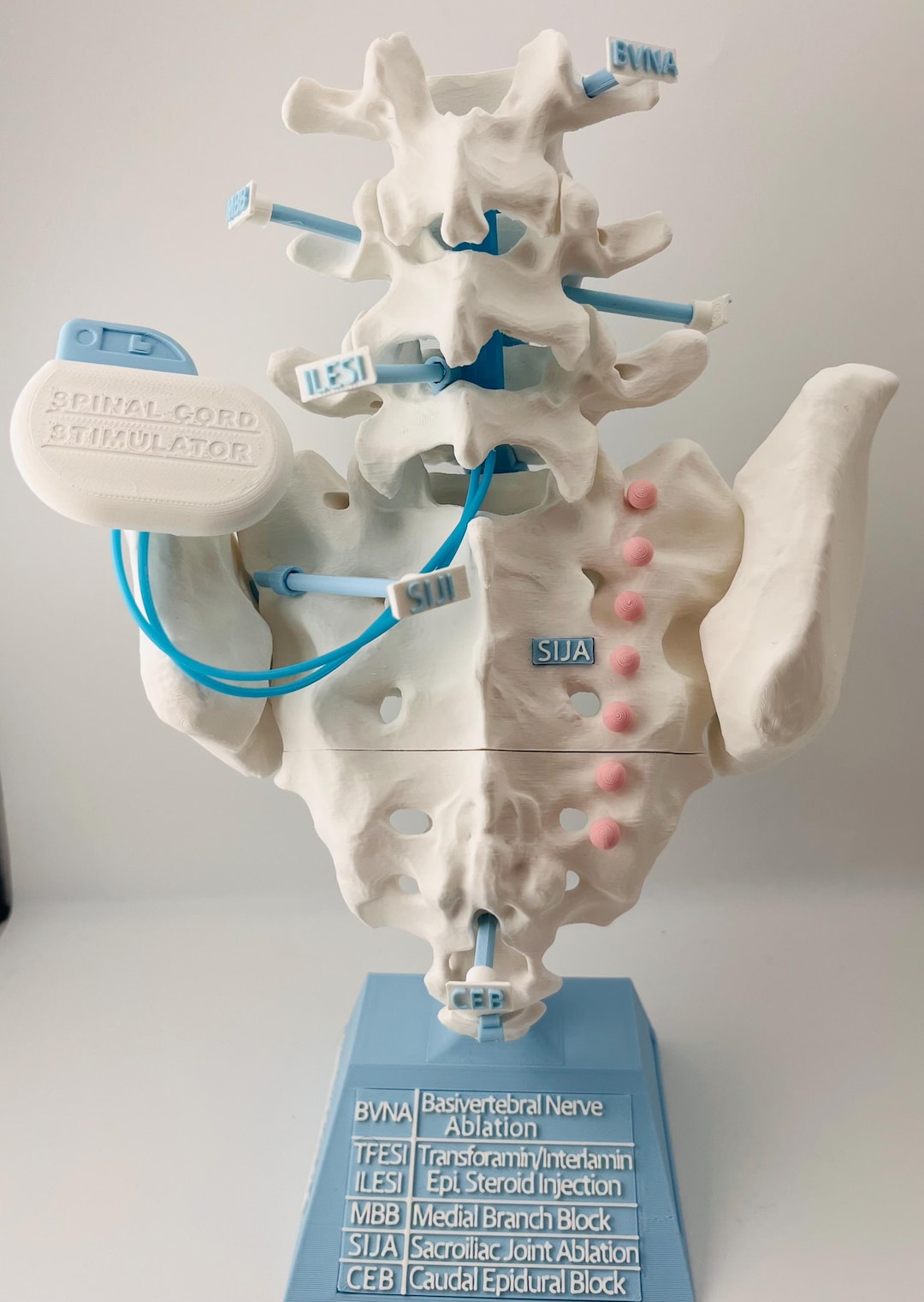 Lumbar/sacrum Model of Pain Management Procedures - Etsy