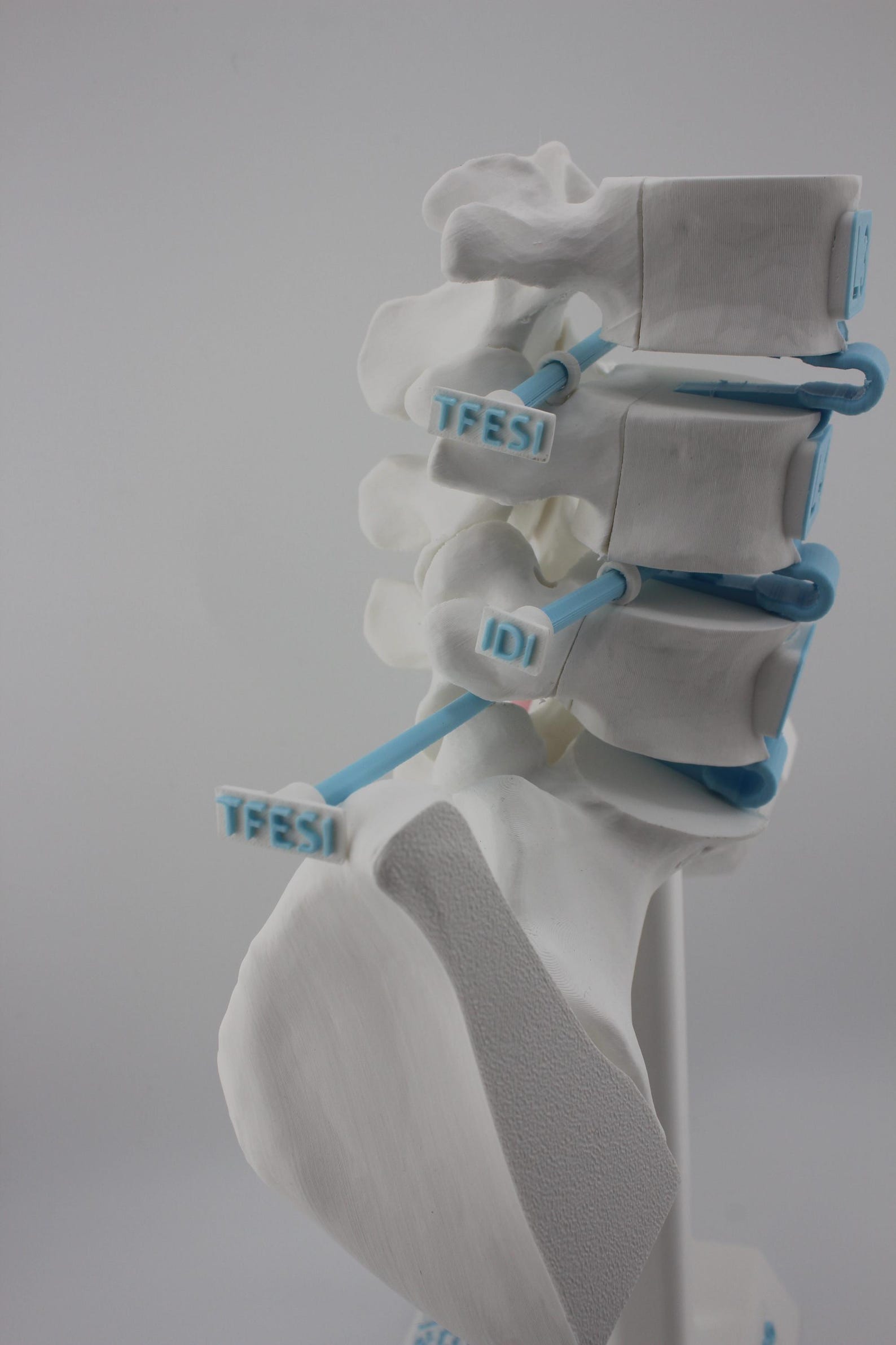 Lumbar/sacrum Model of Pain Management Procedures - Etsy
