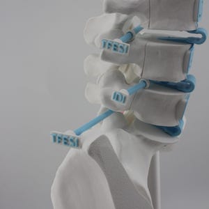 Lumbar/sacrum Model of Pain Management Procedures - Etsy