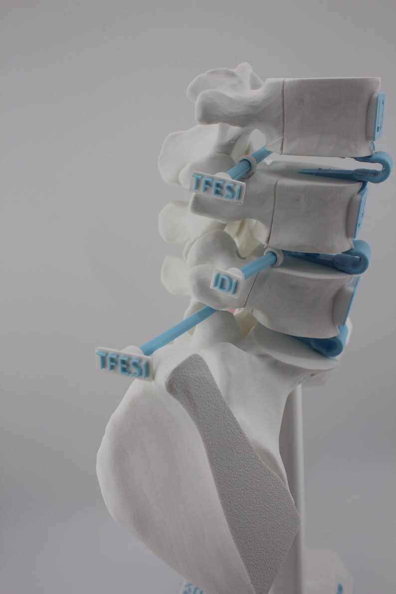 Lumbar/sacrum Model of Pain Management Procedures - Etsy