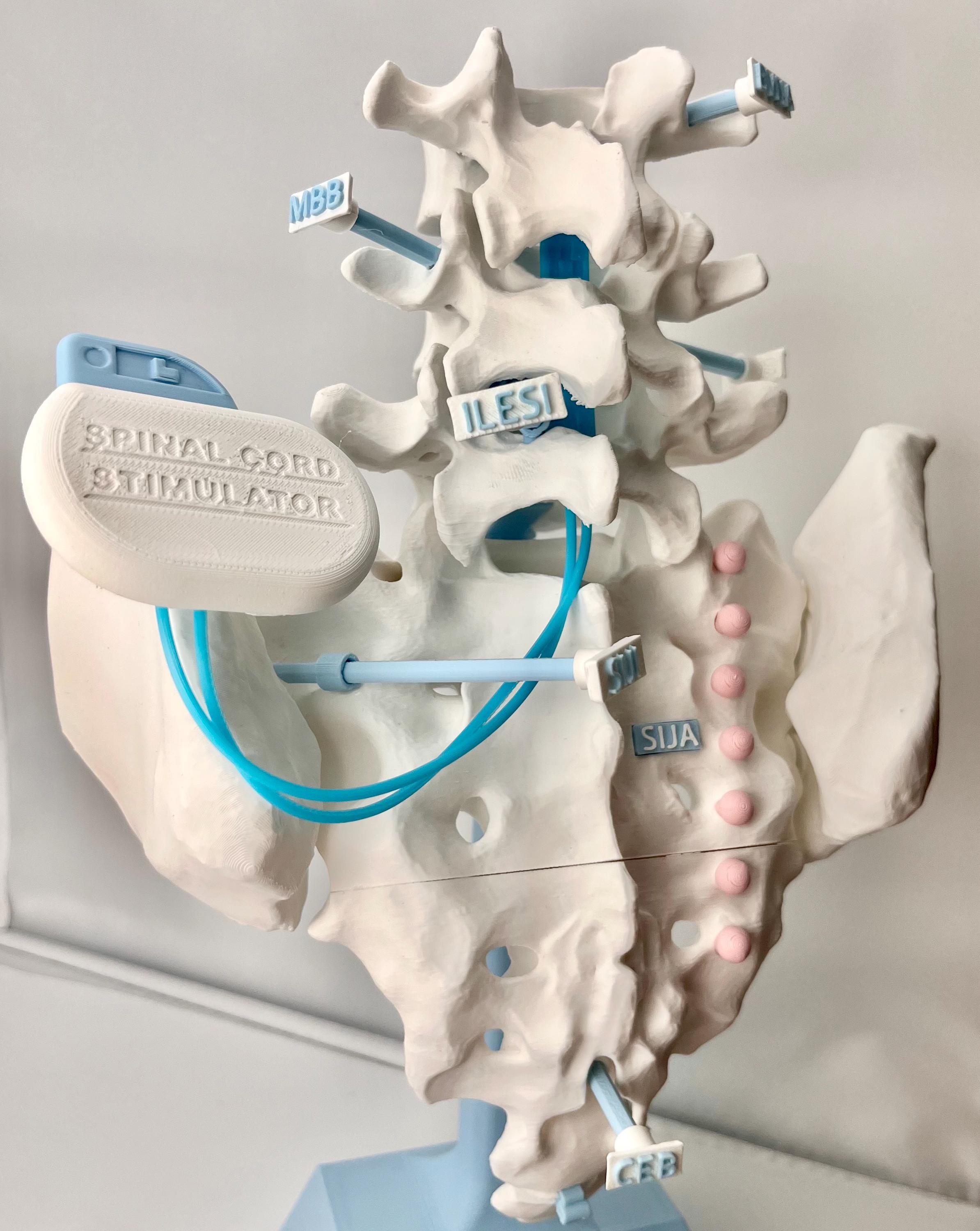 Lumbar/sacrum Model of Pain Management Procedures - Etsy