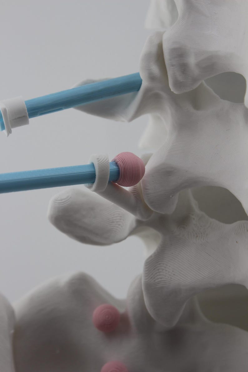 Lumbar/sacrum Model of Pain Management Procedures - Etsy