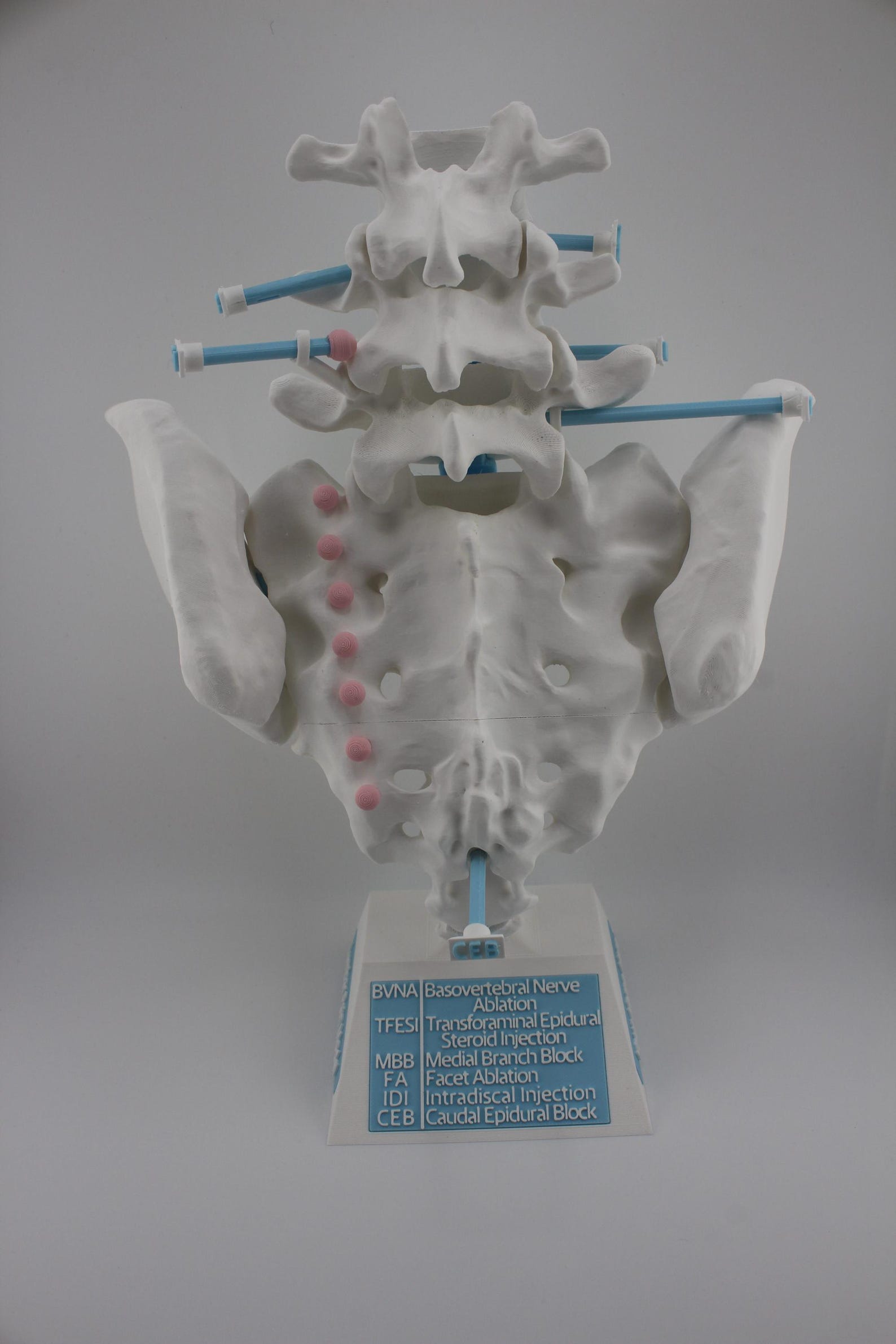 Lumbar/sacrum Model of Pain Management Procedures - Etsy