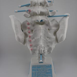 Lumbar/sacrum Model of Pain Management Procedures - Etsy