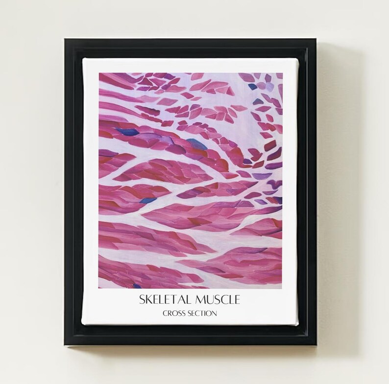 Skeletal Muscle Cells in Cross Section Art Print (with Label) - Etsy