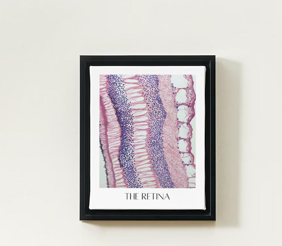 Retina Fine Art Print (with Label) - Etsy