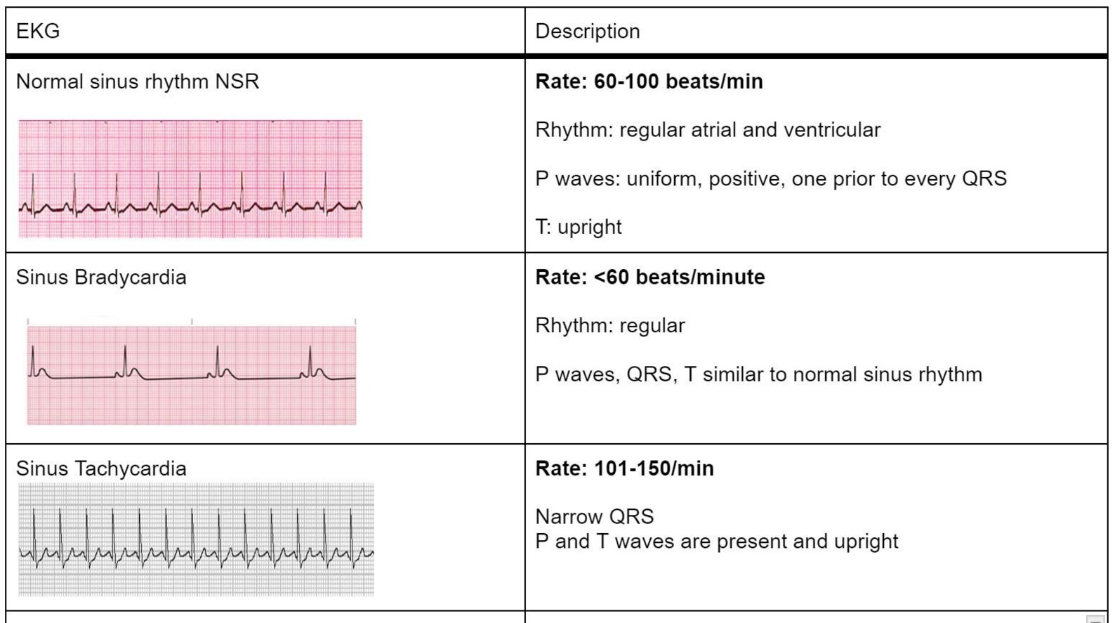 EKG Review Chart - Etsy