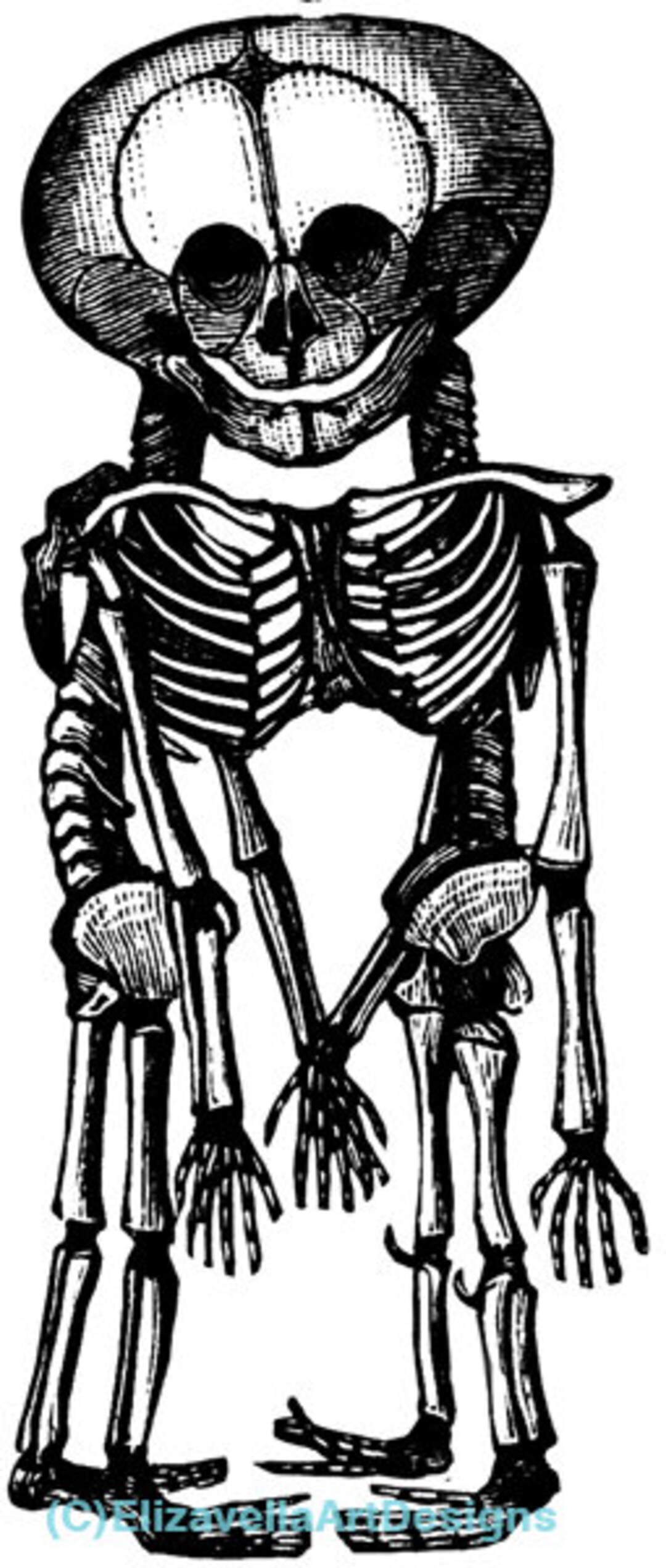 Siamese Twins Skeletons Png Human Anatomy Human Oddities Circus Freaks ...